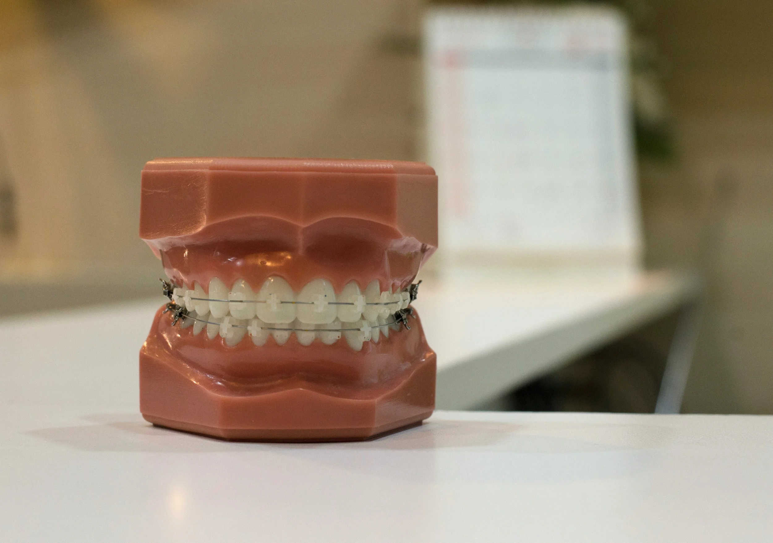 What Is a Dental Arch? A Closer Look at the Structure of Your Smile ...